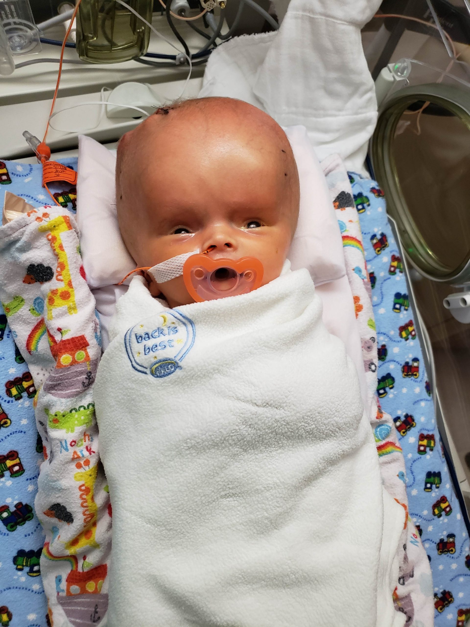 Thirteen surgeries in 13 months was just the beginning: Carter’s ...