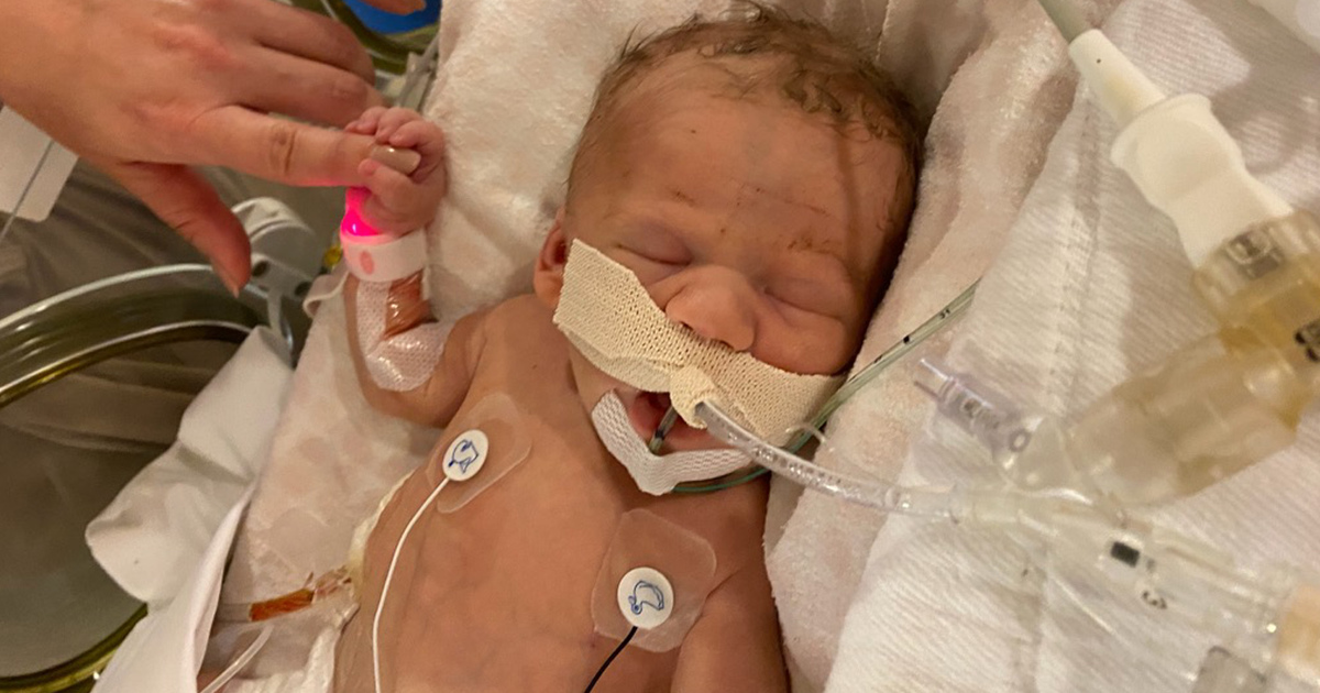 Beating the odds and navigating the unknowns: baby Aria’s story ...