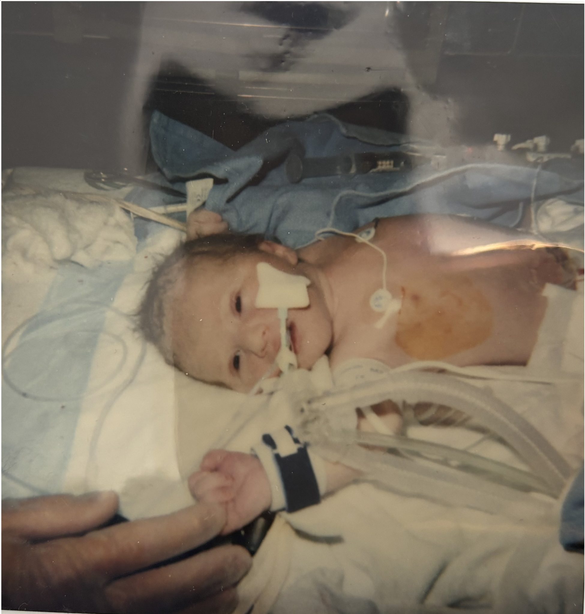 Beating the odds: Brandon’s journey from emergency heart surgery to ...