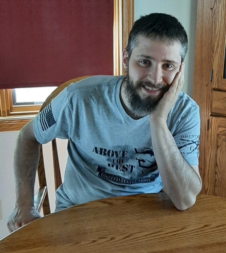 Meet Doug, first patient at Children's Minnesota to undergo pioneering ...