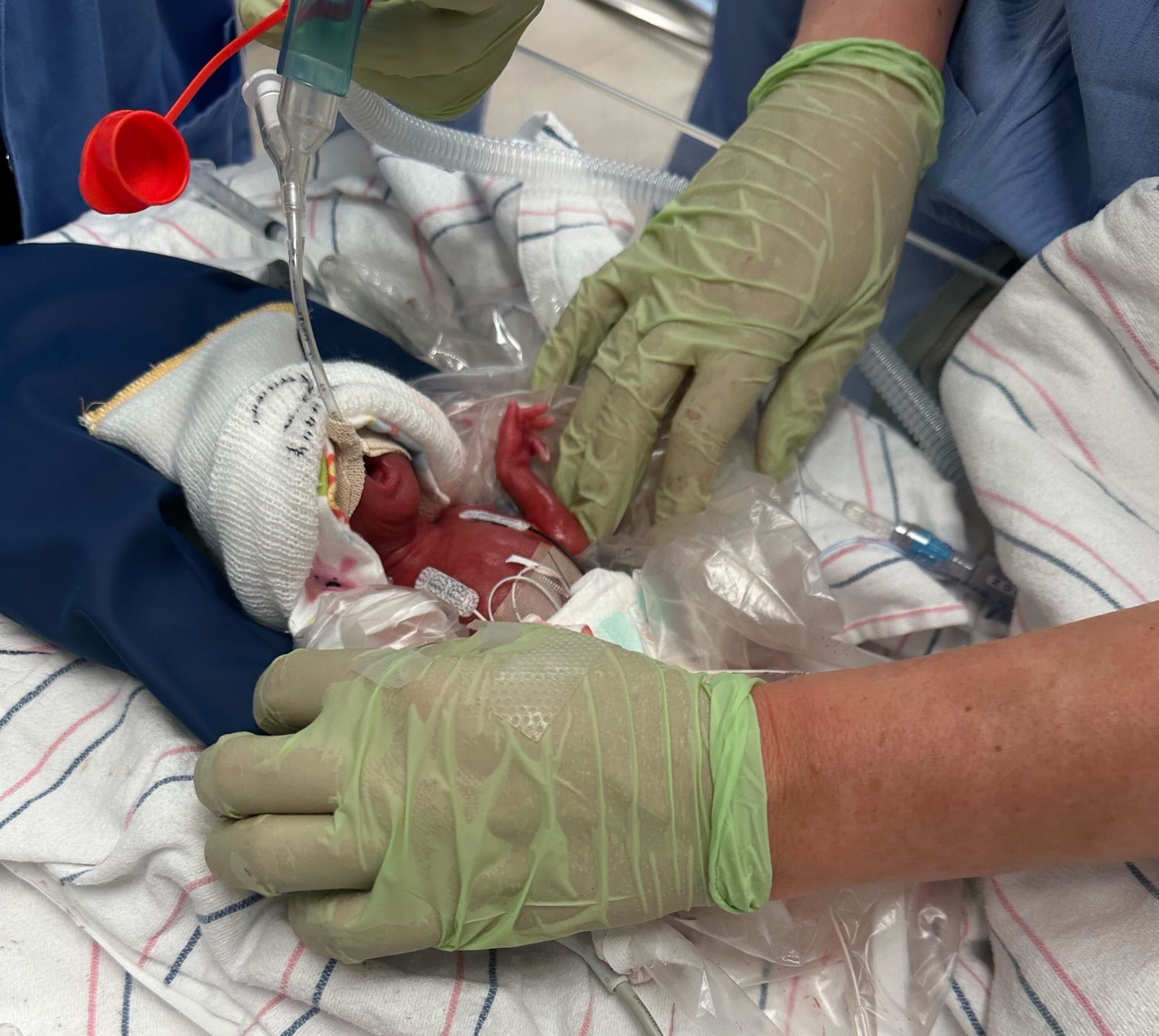 Tiniest baby in the country – and a quintuplet – finally goes home ...