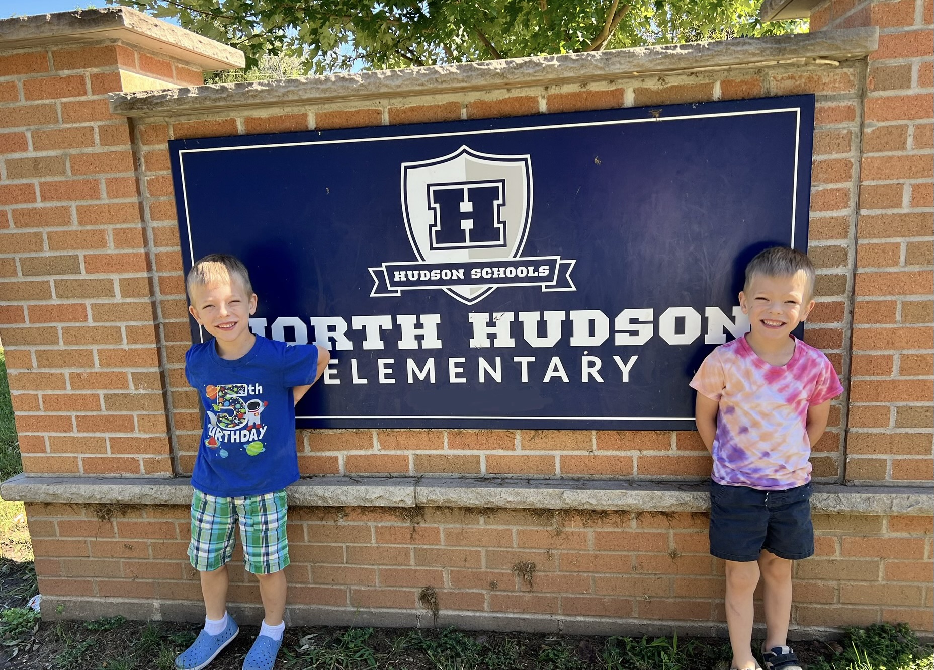 Life-saving care in one place: identical twins beat the odds - Children ...