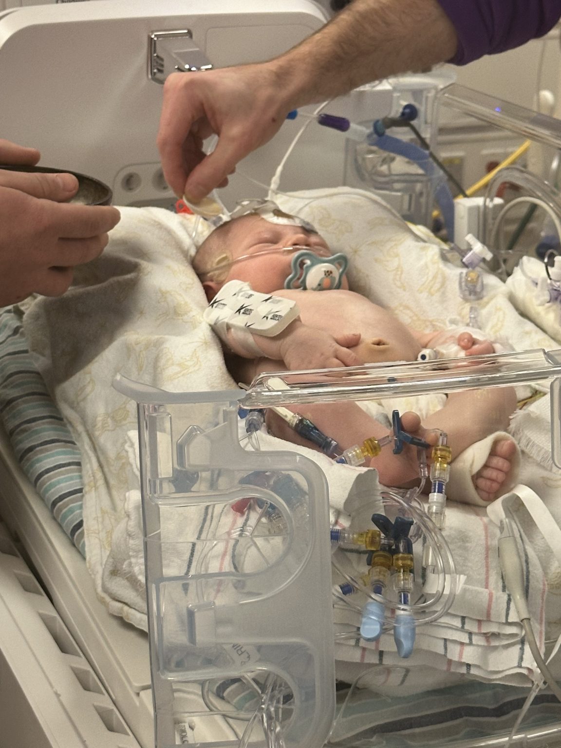 Baby Bennett's 190-mile lifesaving journey - Children's Minnesota
