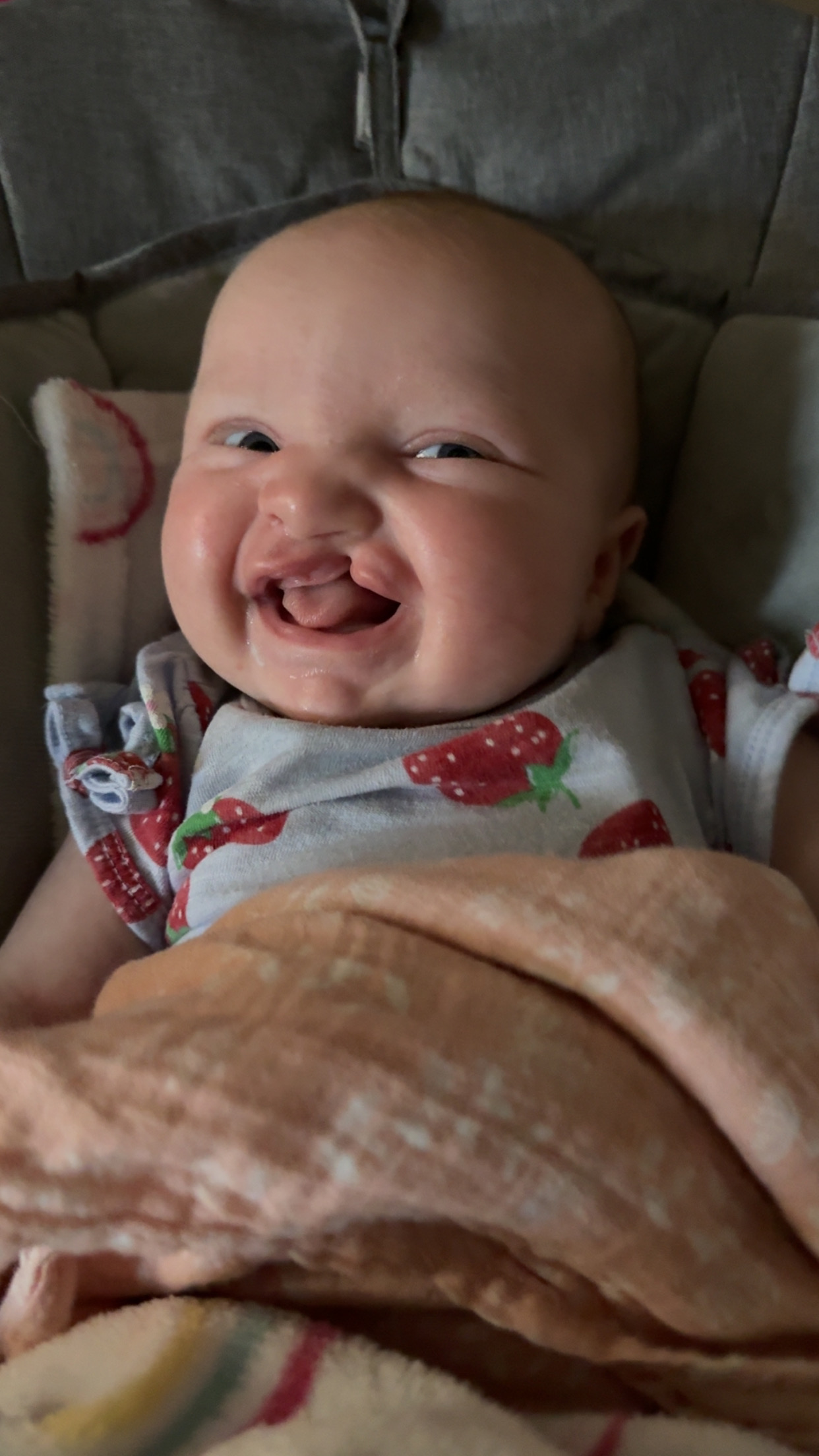 New cleft lip treatment helps Luna to her 'forever smile' - Children's ...