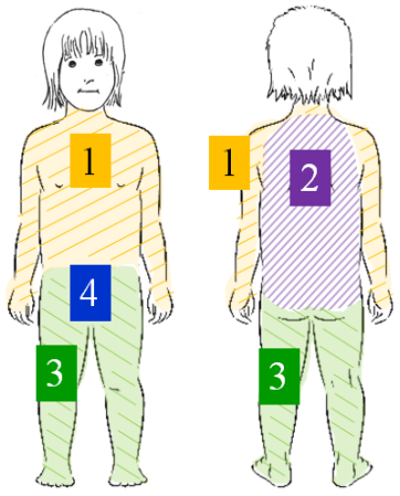 CHG bath 2% Chlorhexidine Gluconate cloths : My Cardiac Journey