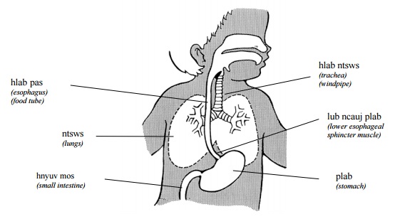 Ua qais ntuav thim hauv plab rov qab los rau pem hlab pas : Neonatal Journey to Home