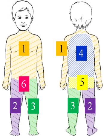 CHG bath 2% Chlorhexidine Gluconate cloths : My Cardiac Journey
