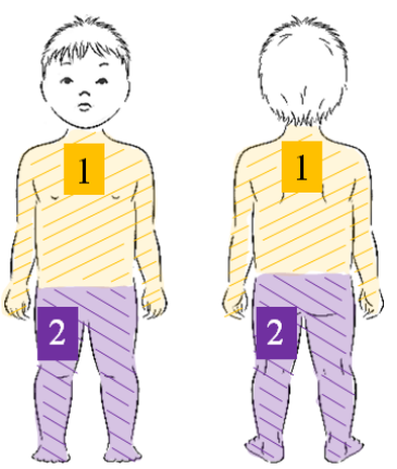 CHG bath 2% Chlorhexidine Gluconate cloths : My Cardiac Journey